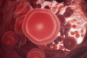 Enhanced External Counterpulsation Treatment | EECP Treatment