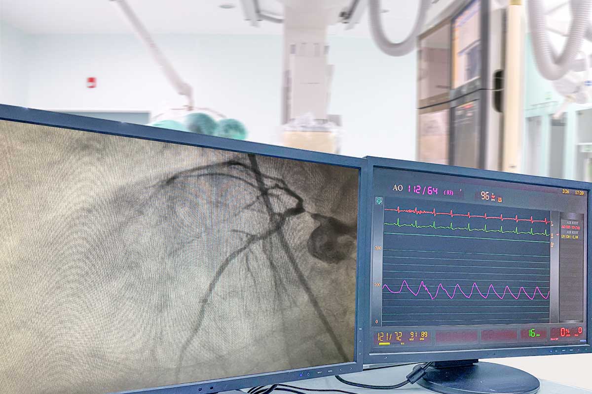 Microcirculation Analysis Health Screening And Medical Check Up Penang